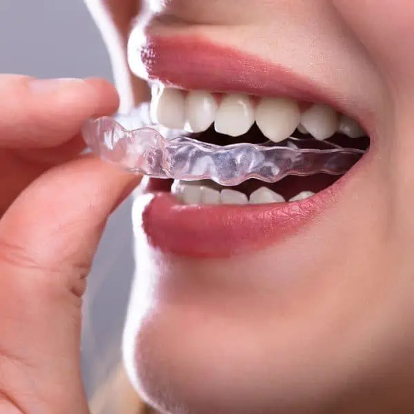 Free Delivery on Invisalign Chewies – Shop Now!
